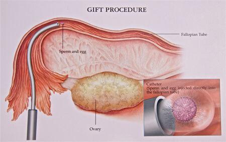 Dr Gan Assisted Conception Resource